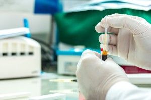 Gilead pushing for swift Sunlenca access in UK as government sets bold ...